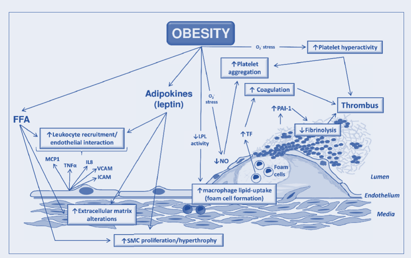 MEDVASC - COVID-19 et Obésité : pourquoi
